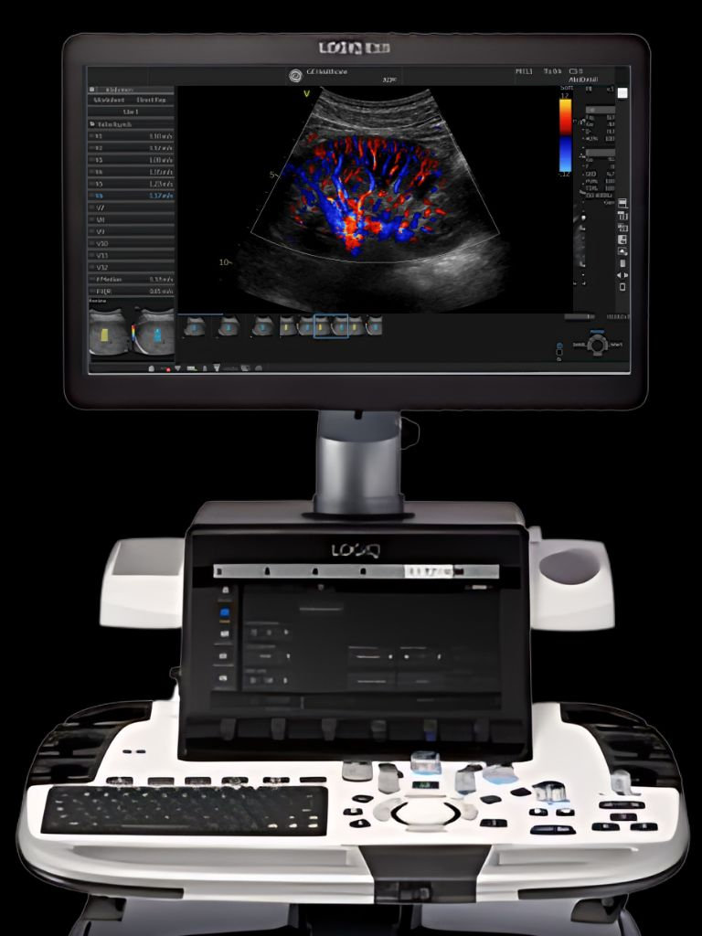 GE Logiq E10 Ultrasound Machine
